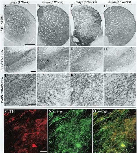 Overview Of ␣ Synuclein Expression In The Striatum A D And Sn Download Scientific