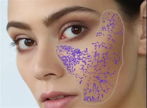 Visia Scan Ai Facial Analysis In Glendale Parfaire