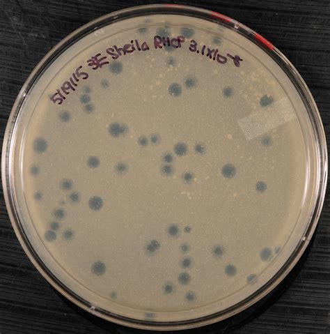 Phage Plaque Detector Object Detection Dataset And Pre Trained Model By