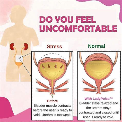 Urine Leakage Patch For Women Postpartum Care Bedwetting Relief And