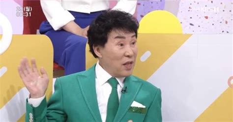 송대관 성형 수술 고백 이 나이에 감출 이유 없어