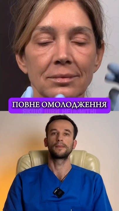 Повна підтяжка обличчя 🔥 Youtube