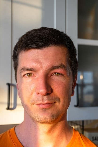 Premium Photo A Red Swollen Eyelid On A Mans Face In Closeup Is An Allergy To An Insect Bite