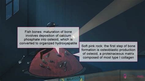 Osteomalacia Rickets Free Sketchy Medical Lesson
