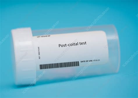 Post Coital Test Stock Image F0420205 Science Photo Library
