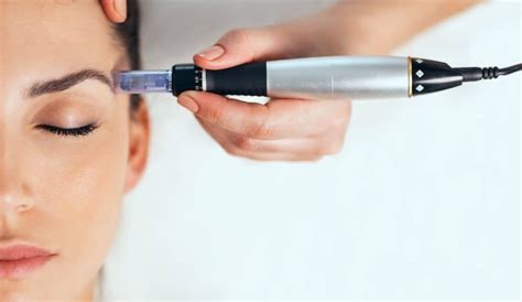 Dermapen Co To Jest I Jakie Daje Efekty E Zikoapteka