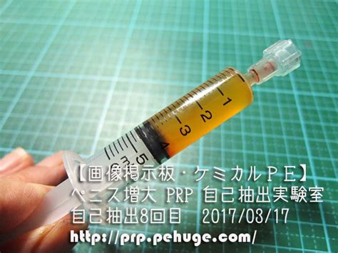 【公式】ケミカルpe・巨根画像掲示板 管理人 On Twitter 久々にprp生成やって見ようと思う 何回も成功してるのでノウハウはある
