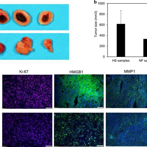 Effect Of Necrosis On The Expression Of Cd31 Ki 67 And Other