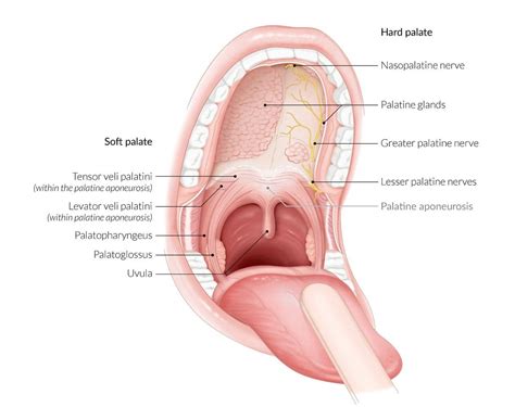 Uvula Speechfit