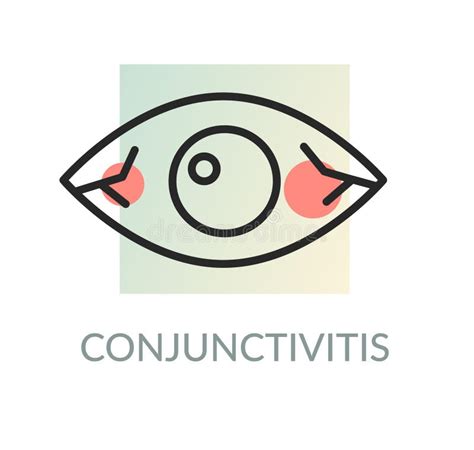 Conjunctivitis Infection In Eye Pink Eye Icon Stock Illustration