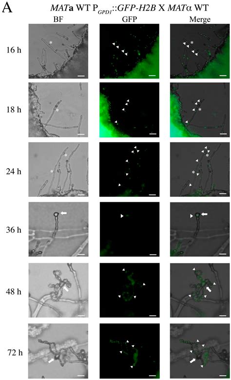 Sexual Differentiation Is Coordinately Regulated By Cryptococcus Neoformans Crk1 And Gat1