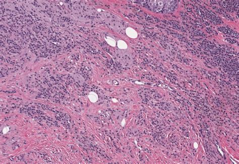 Digital Pathology Zeeromed