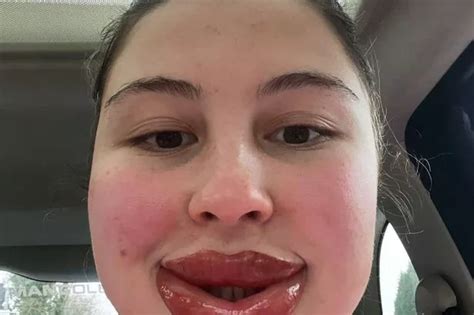 Woman Left With Pout Like Monsters Inc Character After Bid For Perfect