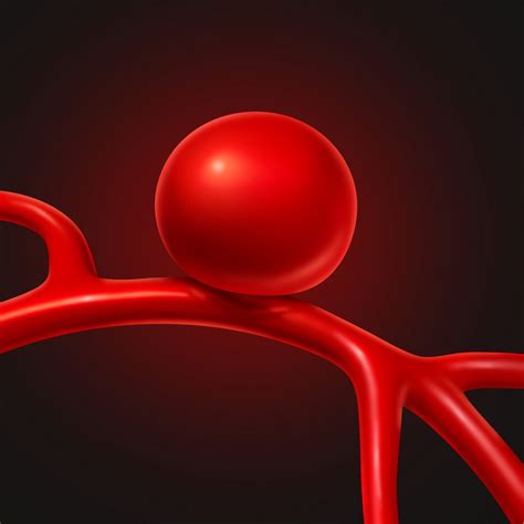 The Dangers Of Subarachnoid Hemorrhage Facty Health