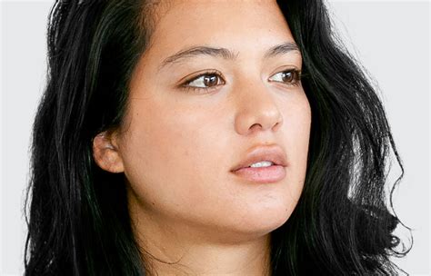 When Can I Do Microneedling Again After Primary Rhinoplasty