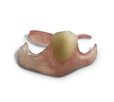 Les Laboratoires Dentaires Gourdy Prothèse Adjointes