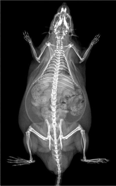 Dual Energy X Ray Absorptiometry How Does It Work