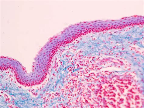 Innovation Grants To Nurture Initial Translational Efforts IGNITE