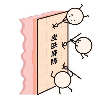 皮肤屏障受损的具体表现 伊的家