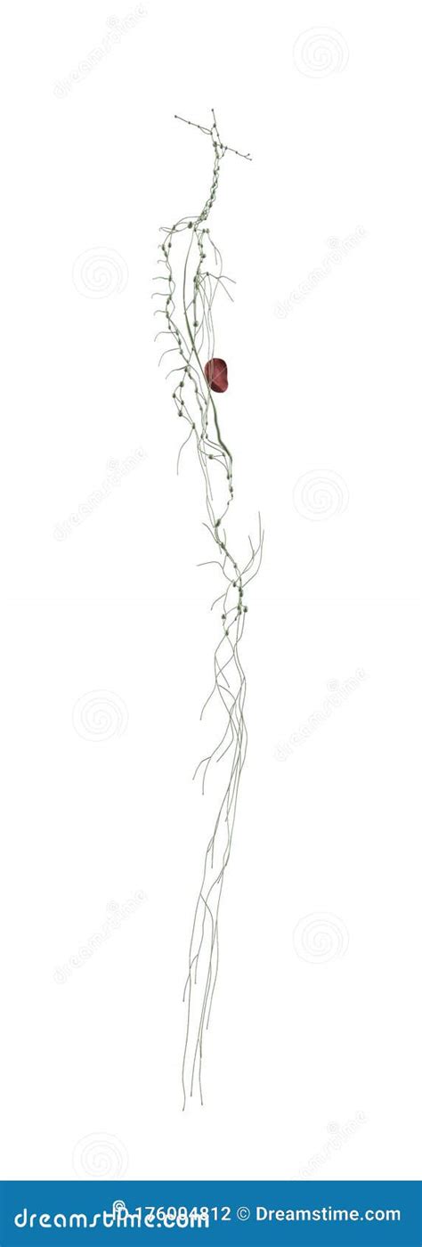 Female Lymphatic System X Ray Royalty Free Illustration Cartoondealer