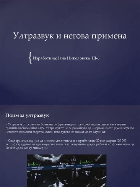 Презентација за ултразвук Pdf