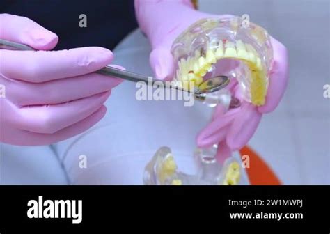 Dentist Shows The Patient On The Model Of The Jaw How To Properly Treat