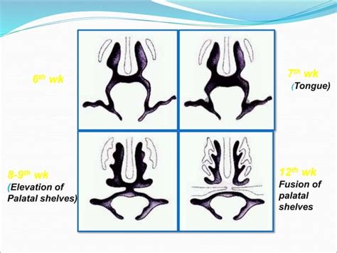Development Of Palateppt