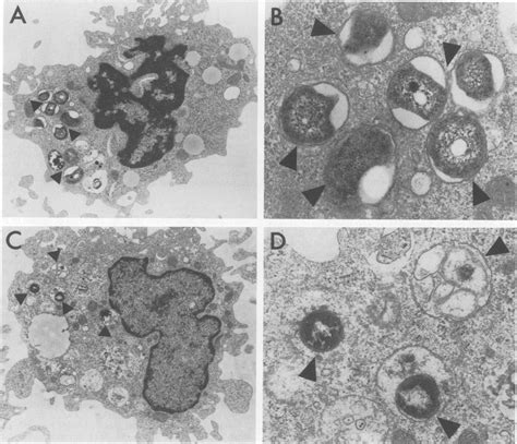 Bordetella Pertussis Electron Micrograph