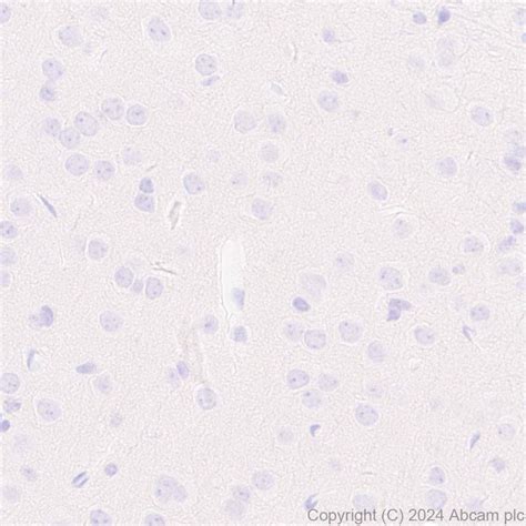 Anti Pseudomonas Outer Membrane Porin F Antibody [epr28629 91