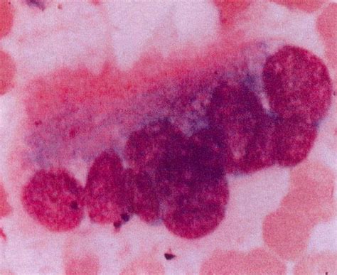 图2 24 纤毛柱状上皮细胞 宫颈脱落细胞