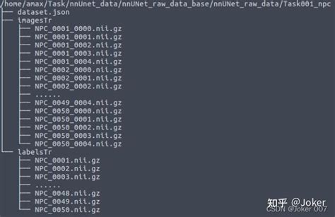 分割模型nnUNet学习日记一在Ubuntu系统下如何快速使用nnUNet跑通自己的数据 知乎