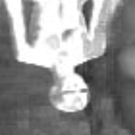 Stream Pcp Linux By Valtielyin Yang Listen Online For Free On Soundcloud