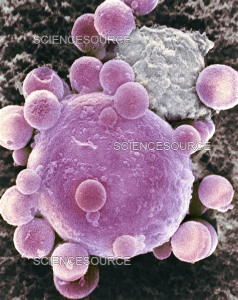 Lymphocyte Attacking Cancer Cell Sem Stock Image Science Source Images