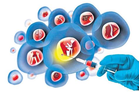 Stem Cell Treatments Dr Sujata Kar By Dr Sujata Kar Medium