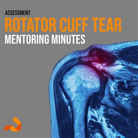 Rotator Cuff Assessment