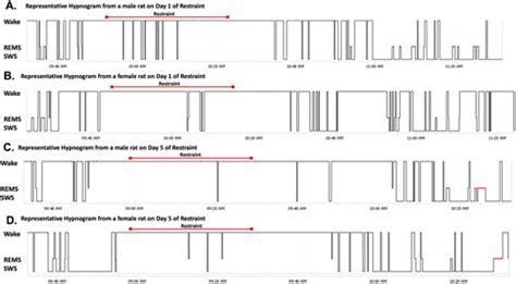 Full Article Sex Differences In Body Temperature And Neural Power