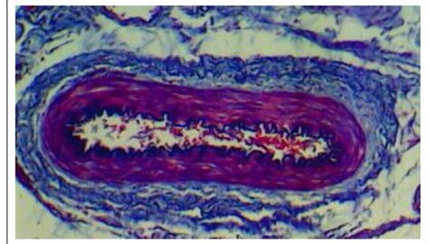 Artery Vein Cross Section Diagram Quizlet