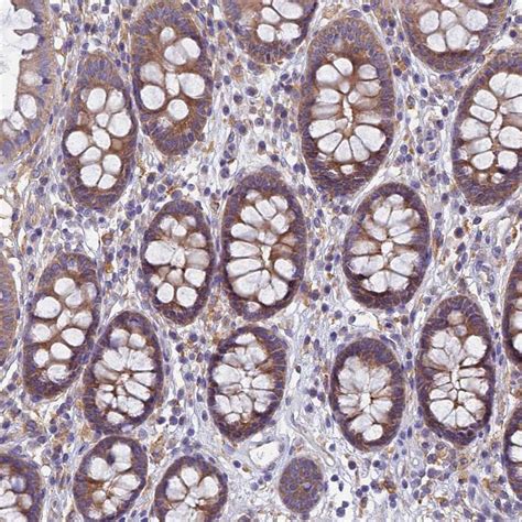 Rabbit Polyclonal Anti Eea1 Antibody Buy For Research Highly