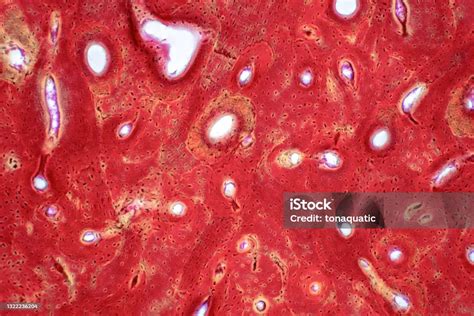 가벼운 현미경 보기 근육 뼈 연결 및 결합 조직에서 인간 소형 뼈 조직의 병리학 긴에 대한 스톡 사진 및 기타 이미지 긴 뼈 0명 Istock