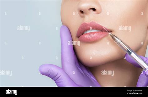 Cropped Sensual Female Lips Procedure Lip Augmentation Syringe Near Womans Mouth Injections