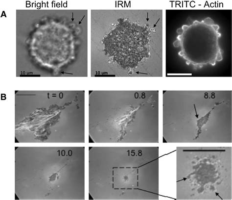 Cell Spreading At Carol Freda Blog
