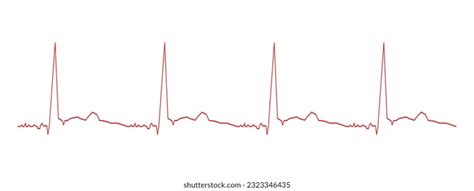 Red Heartbeat Diagram Electrocardiogram Chart Heart Stock Vector