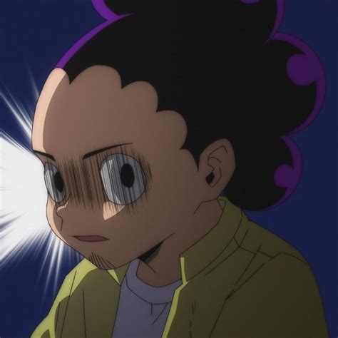 Receding Hairline At 25 Years Old Lmfaoo