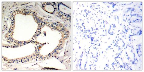 Ikb Ephospho Ser22 Antibody Sab Signalway Antibody