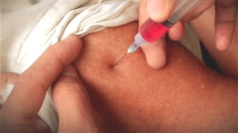 Injection Lagane Ka Tarika How To Give Intramuscular Injection Nursing School Ep 05 Youtube