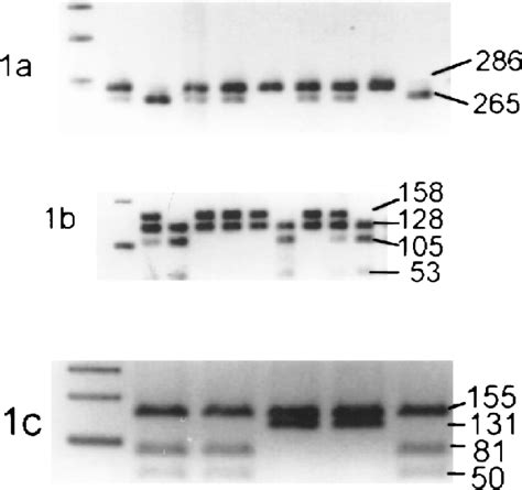 Digestion Of Pcr Product Ghre10f Ghre10r With A Nari B Nlaiii Download Scientific