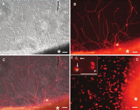 Photomicrographs Of Retinal Explants Showing Characteristics Of A