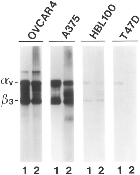 Analysis Of The Vitronectin Receptor From Hbl 100 T47d A375 And Download Scientific Diagram