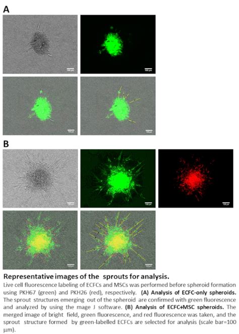 Three Dimensional Angiogenesis Assay System Using Co Culture Spheroids