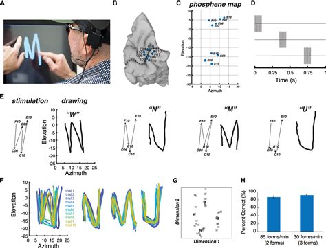 Figure 6 From Dynamic Stimulation Of Visual Cortex Produces Form Vision In Sighted And Blind